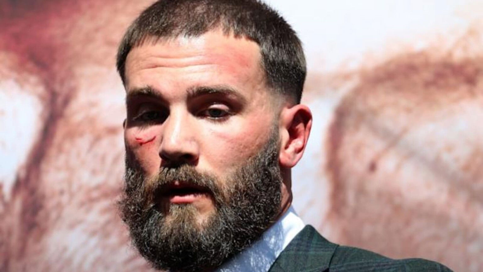 "Glasses scratched his face," Caleb Plant's manager reveals details ...