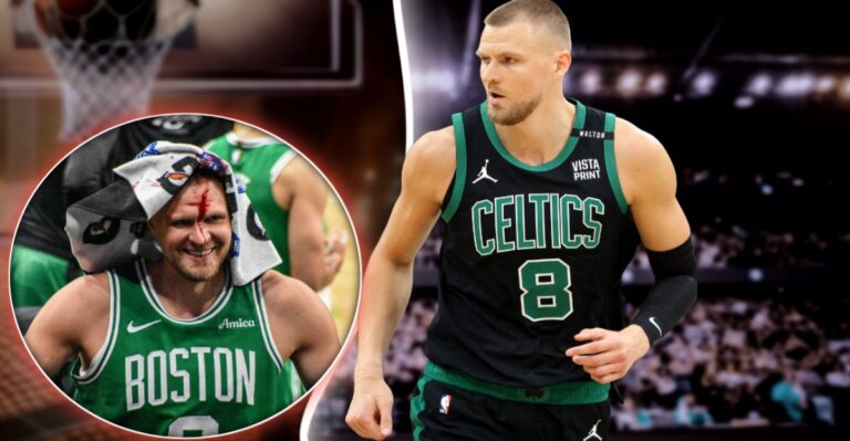 Bloodied Kristaps Porzingis smiles his way to the medical room in Game ...